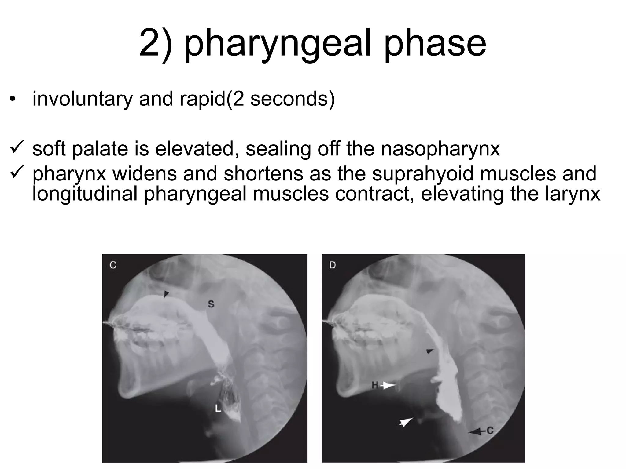 Fluoroscopic techniques and anatomy of pharynx and esophagus final | PDF
