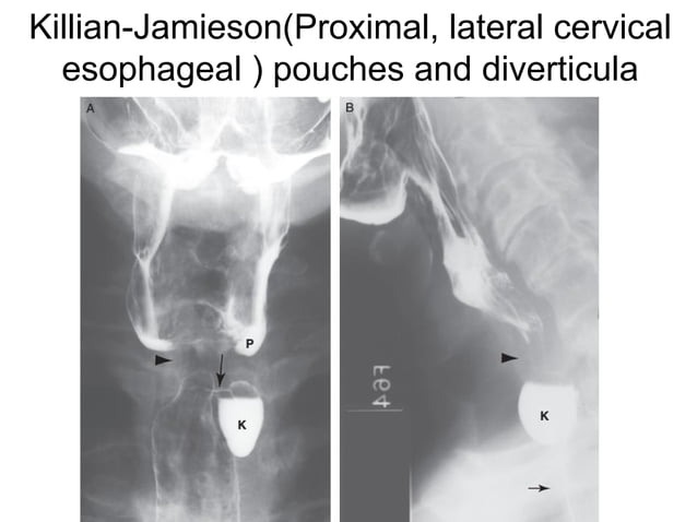 Fluoroscopic techniques and anatomy of pharynx and esophagus final | PDF