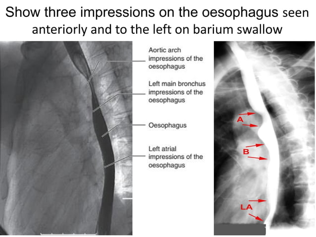 Fluoroscopic techniques and anatomy of pharynx and esophagus final | PDF