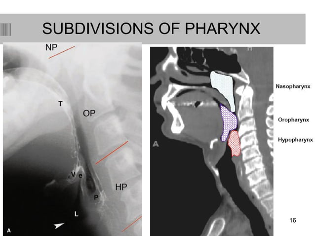Fluoroscopic techniques and anatomy of pharynx and esophagus final