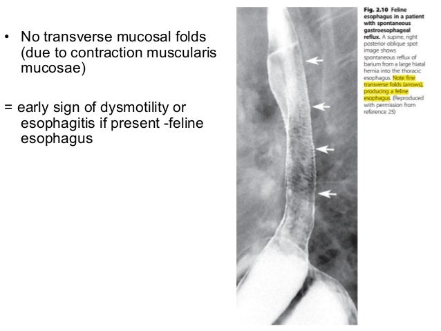 Fluoroscopic techniques and anatomy of pharynx and esophagus final