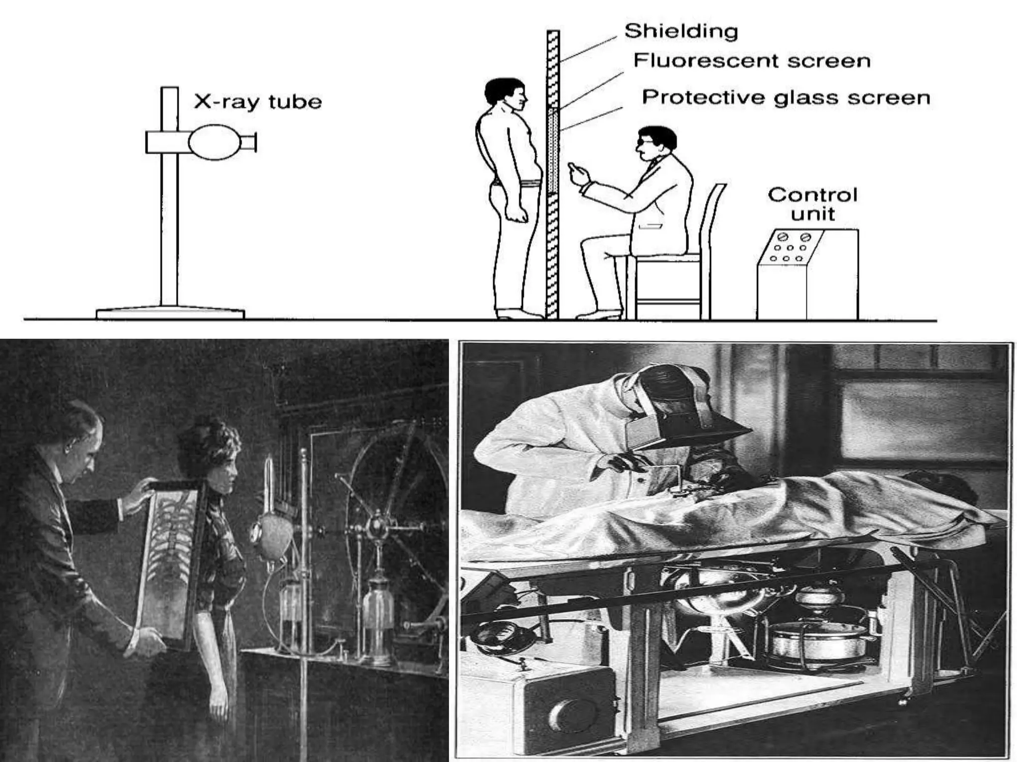 Fluoroscopy-Rohit.pptx
