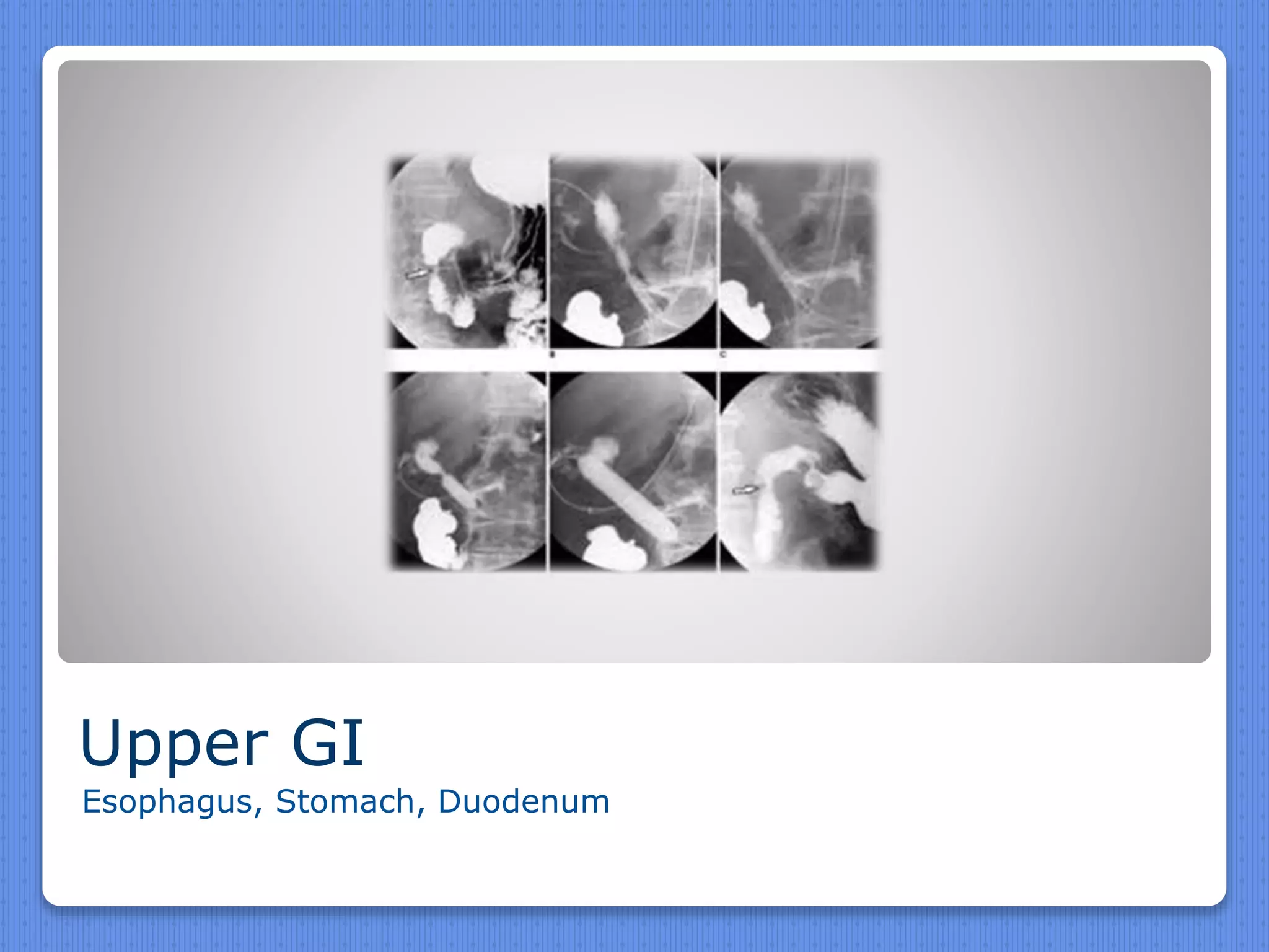 Fluoroscopy for the Radiologic Technologist | PPTX