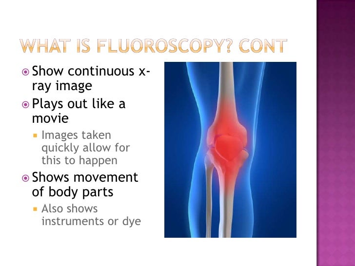 Fluoroscopy Ppt