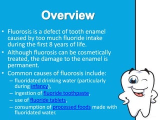 Dental Fluorosis | PPTX