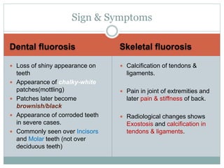 Fluorosis | PPT