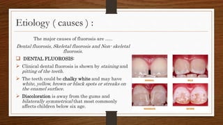 Fluorosis.pptx