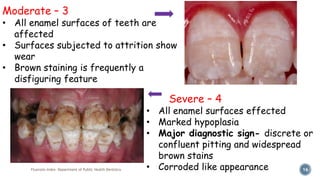 Fluorosis index | PPTX