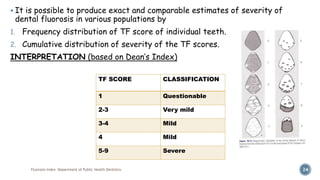 Fluorosis index | PPTX