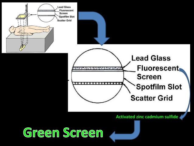 Fluroscopy | PPTX | Eye and Vision Conditions | Diseases and Conditions