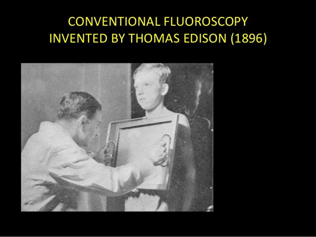 Fluroscopy