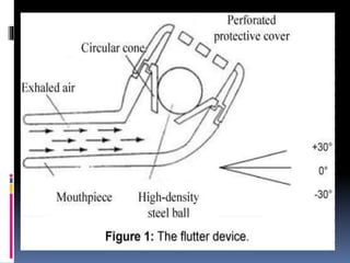 Flutter a device for clearance of airway | PPTX