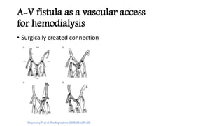 PULSATILE VENOUS FLOW IN LEGS | PPT