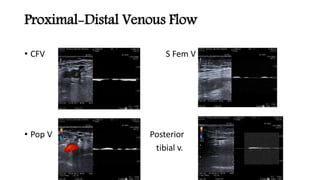 PULSATILE VENOUS FLOW IN LEGS | PPT