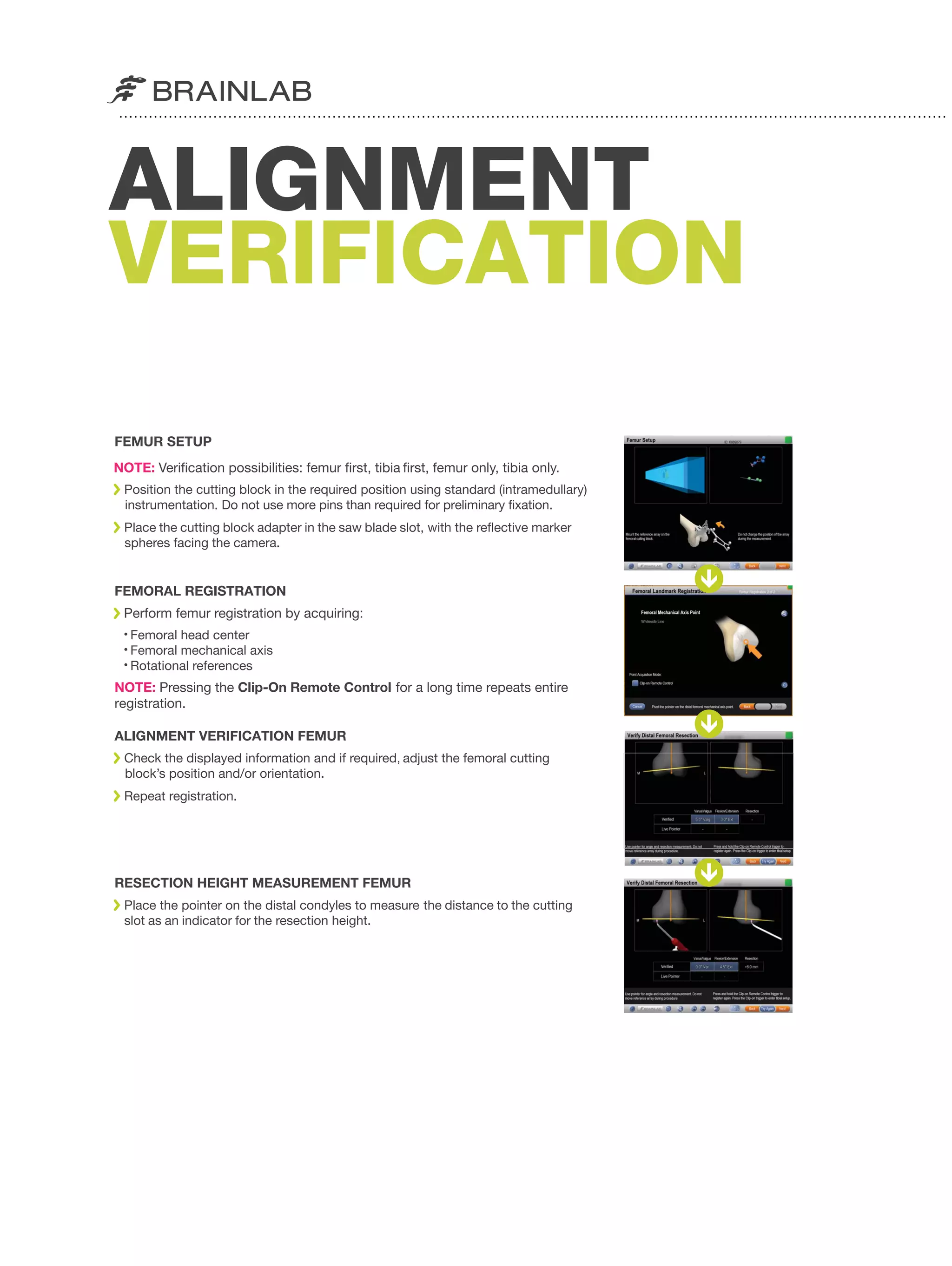 Brainlab Knee Express for Alignment Verification Flyer | PDF