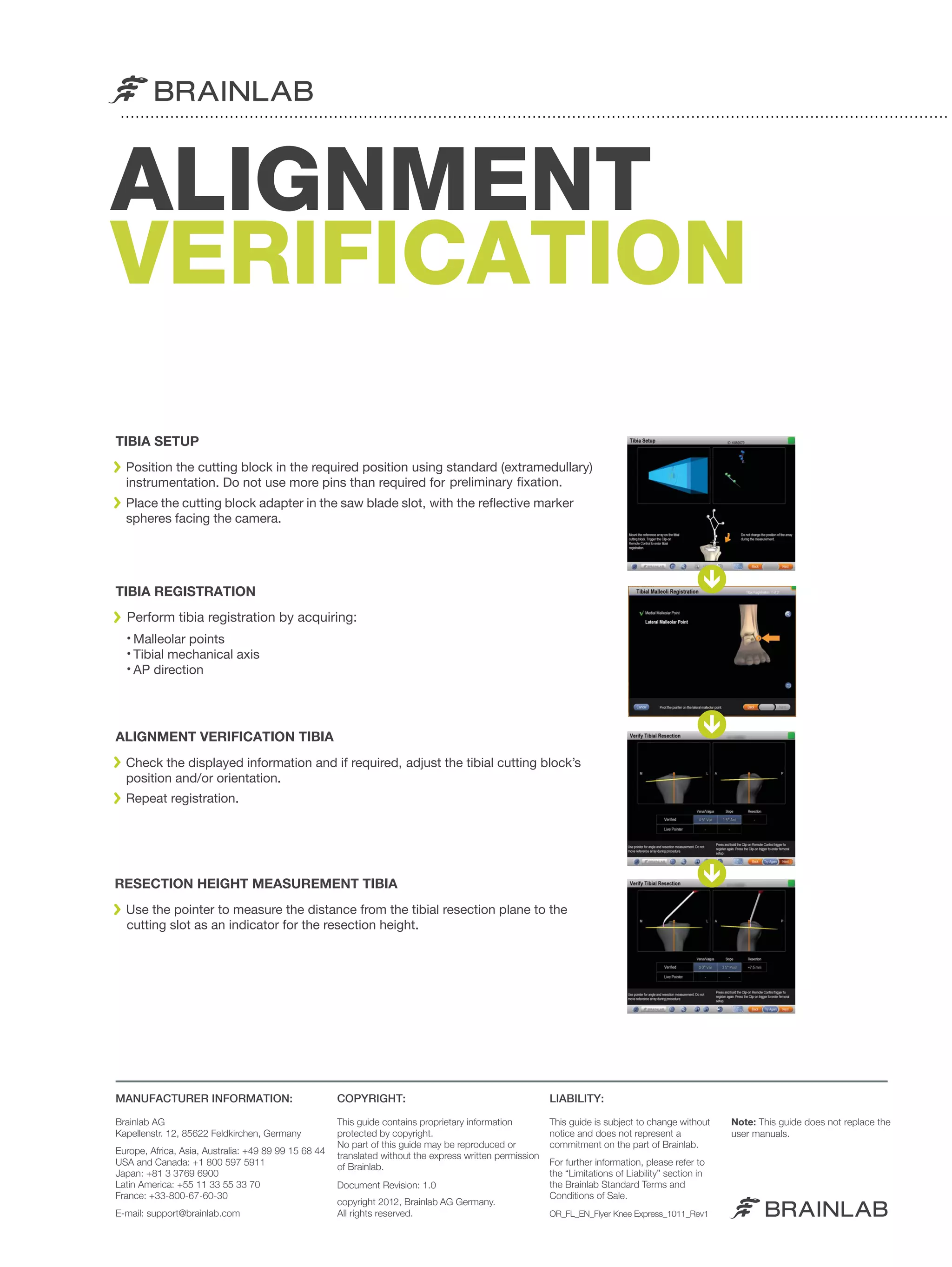 Brainlab Knee Express for Alignment Verification Flyer | PDF