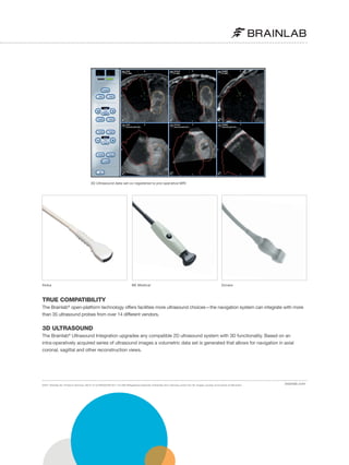 Brainlab Ultrasound Integration Flyer | PDF