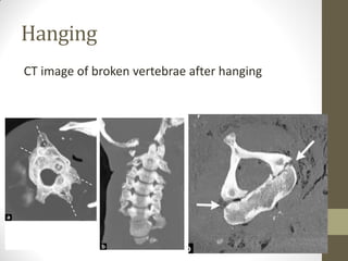 Imaging techniques in forensic medicine | PDF