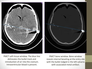 Imaging techniques in forensic medicine | PDF
