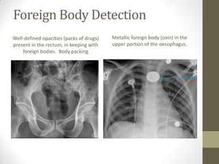 Imaging techniques in forensic medicine | PDF