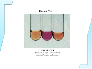 BIOCHEMICAL TEST IN MICROBIOLOGY | PPTX