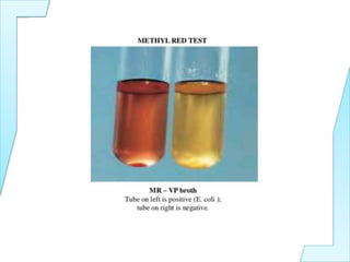 BIOCHEMICAL TEST IN MICROBIOLOGY | PPTX