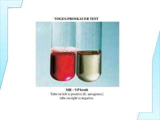 BIOCHEMICAL TEST IN MICROBIOLOGY | PPTX