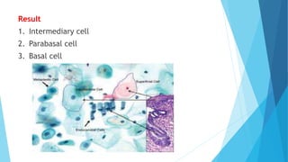 Horological Diagnosis of Cervical cancer.pptx