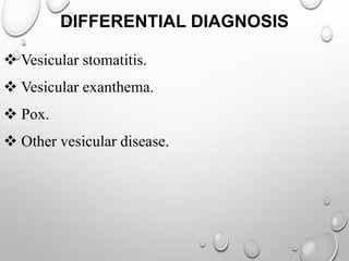 Foot and mouth disease | PPTX