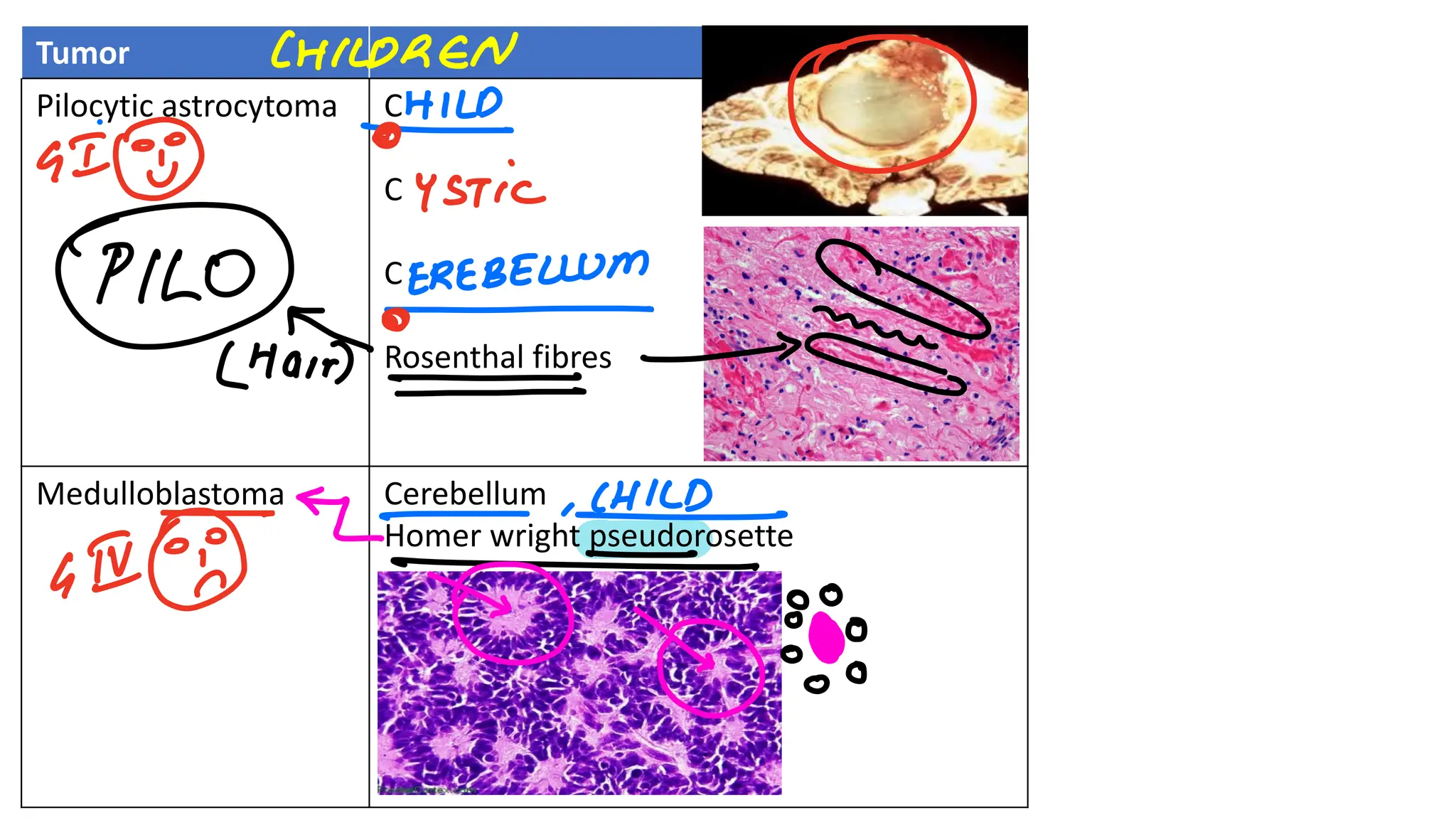 FMGE LRR Pathology Part 1.pdf by dr Preethi sharma | PDF