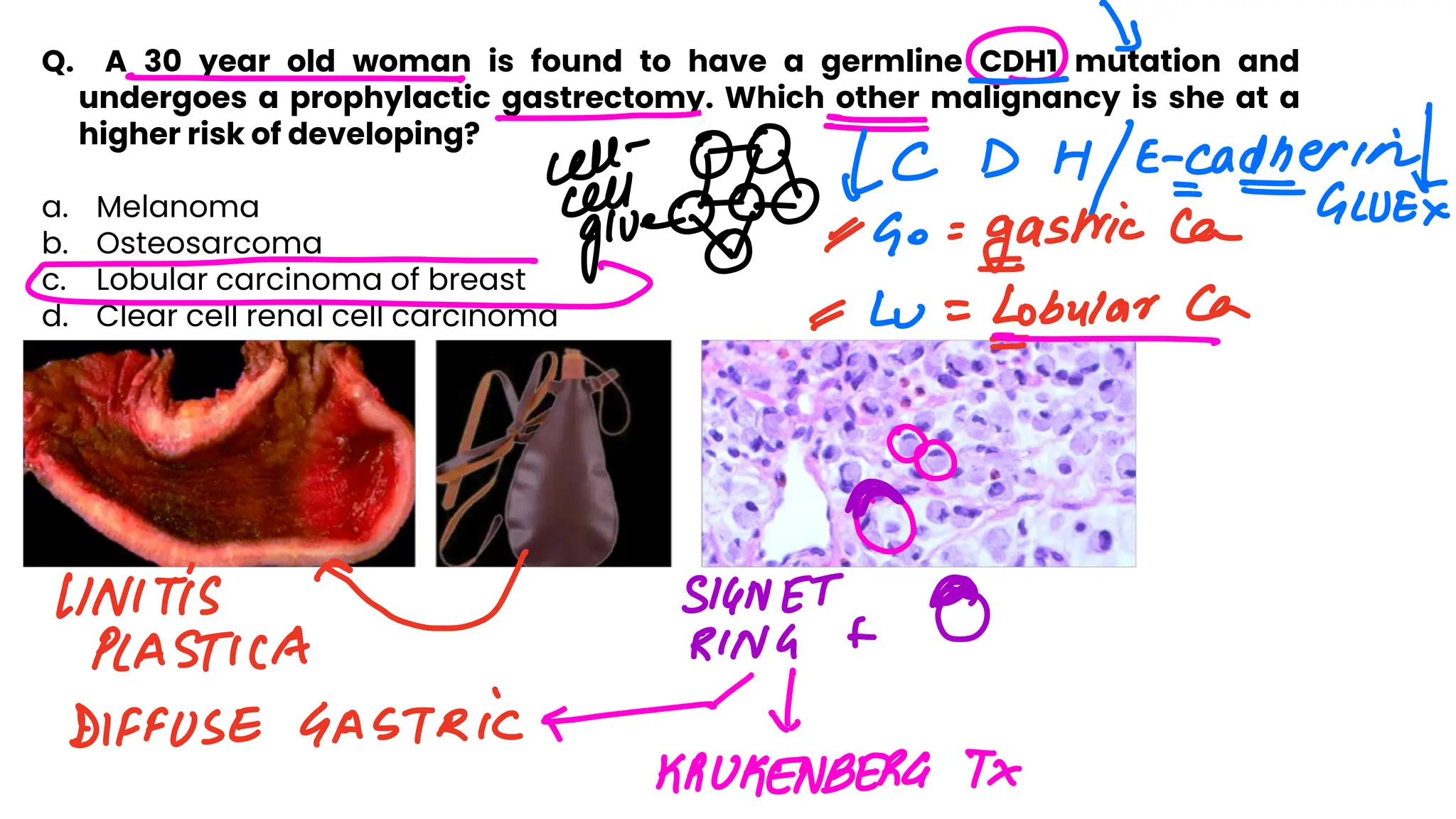 FMGE LRR Pathology Part 1.pdf by dr Preethi sharma | PDF