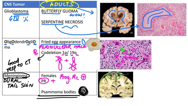 FMGE LRR Pathology Part 1.pdf by dr Preethi sharma | PDF