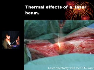 Mode of Action of Laser In Tissues | PPT