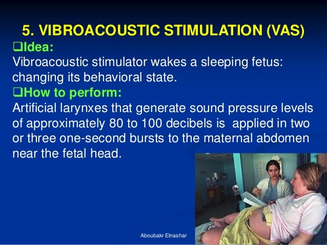 Antepartum Fetal Surveillance: Aboubakr Elnashar