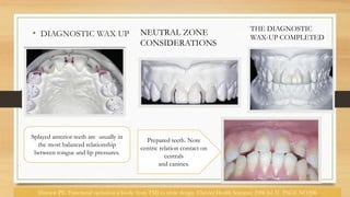 FMR/ Full mouth rehabilitation final.7.1.2021pptx | PPTX