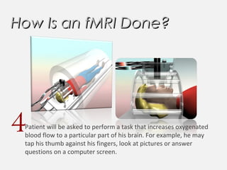 Functional MRI | PPT