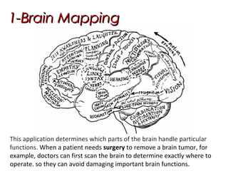 Functional MRI | PPT