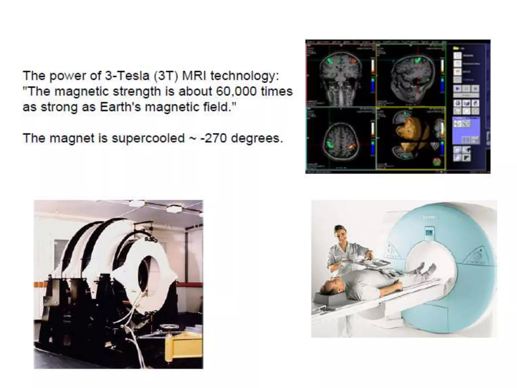 FMRI.ppt