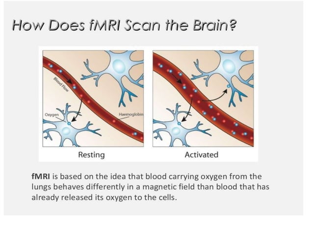 FMRI.ppt | Medical Tests | Medical Health