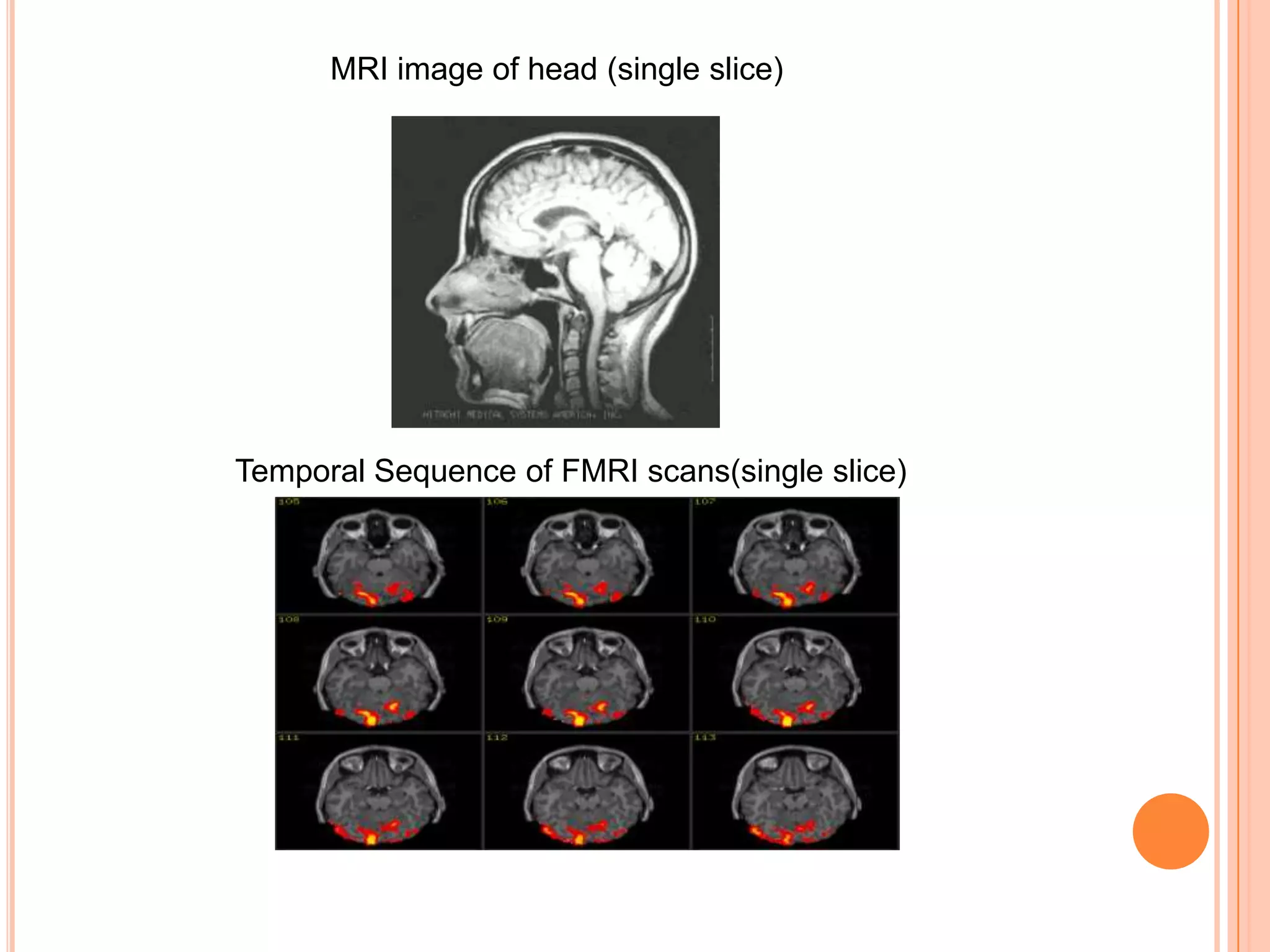 Fmri bci interface for neuroscientific research and treatment | PPT