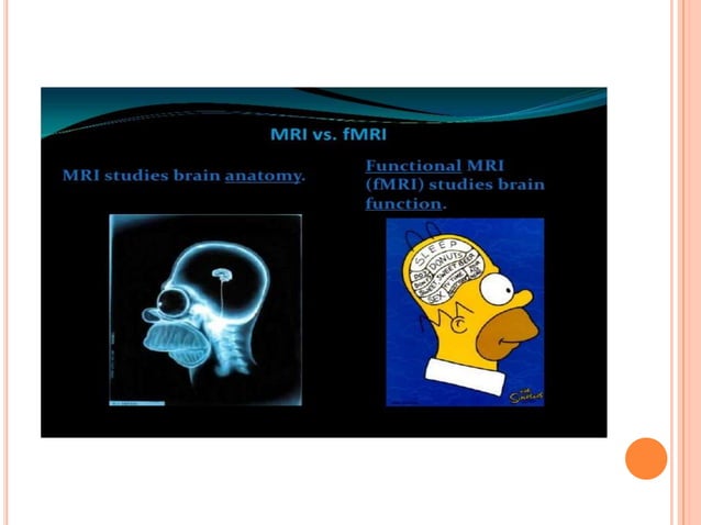 Fmri bci interface for neuroscientific research and treatment | PPT