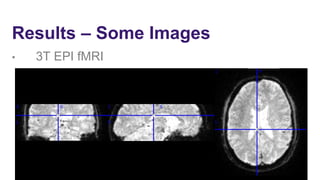 FMRI medical imagining | PPT