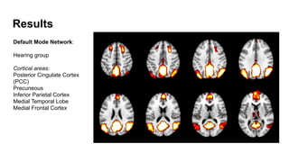 Brain structural connectivity and functional default mode network in deafness | PDF