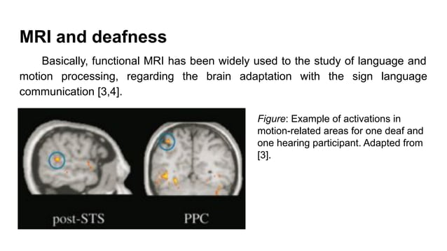 Brain structural connectivity and functional default mode network in ...
