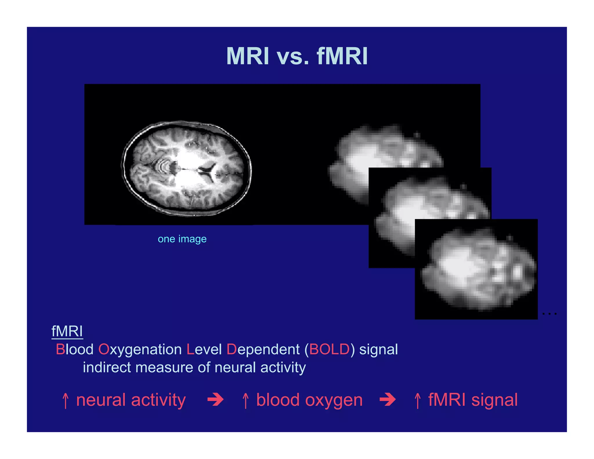 Cosmo-not: a brief look at methods of analysis in functional MRI and in ...