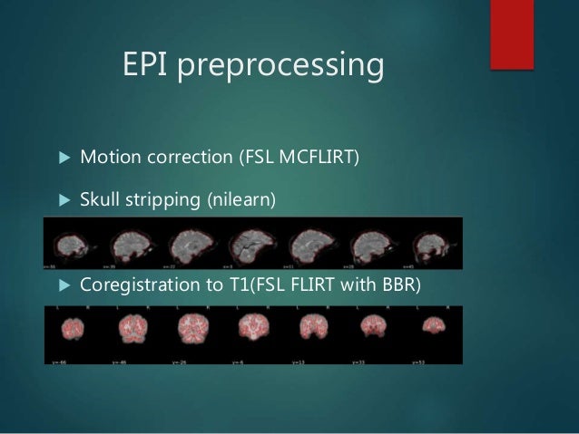 Fmriprep Robust And Easy To Use Fmri Preprocessing Pipeline