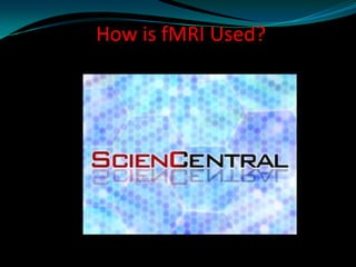 fMRI Presentation | PPTX