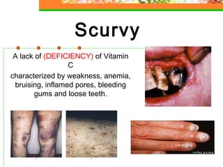 Fn1 ppt. vitamins and minerals | PPT