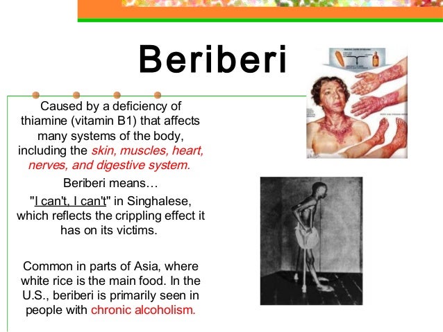 Fn1 ppt. vitamins and minerals