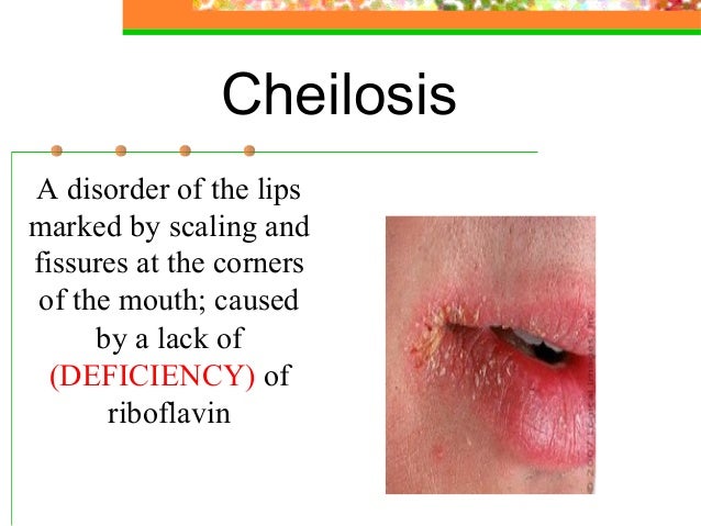 Fn1 ppt. vitamins and minerals